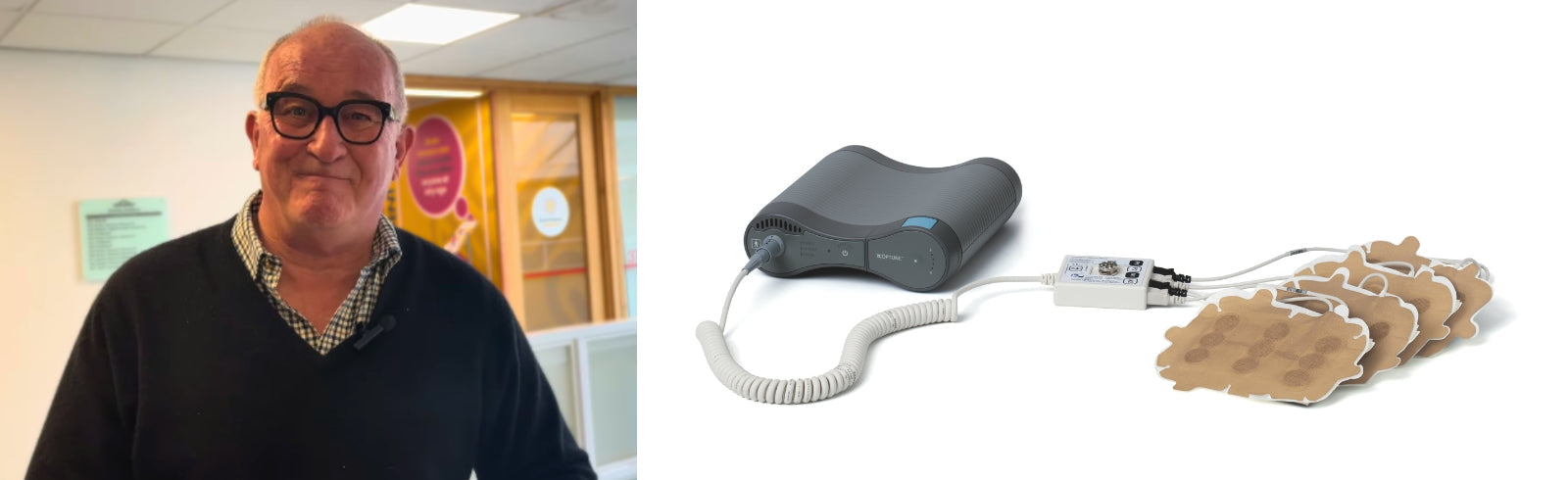 Tumour Treating Fields – an update | Brain Tumour Campaigning – Brain ...