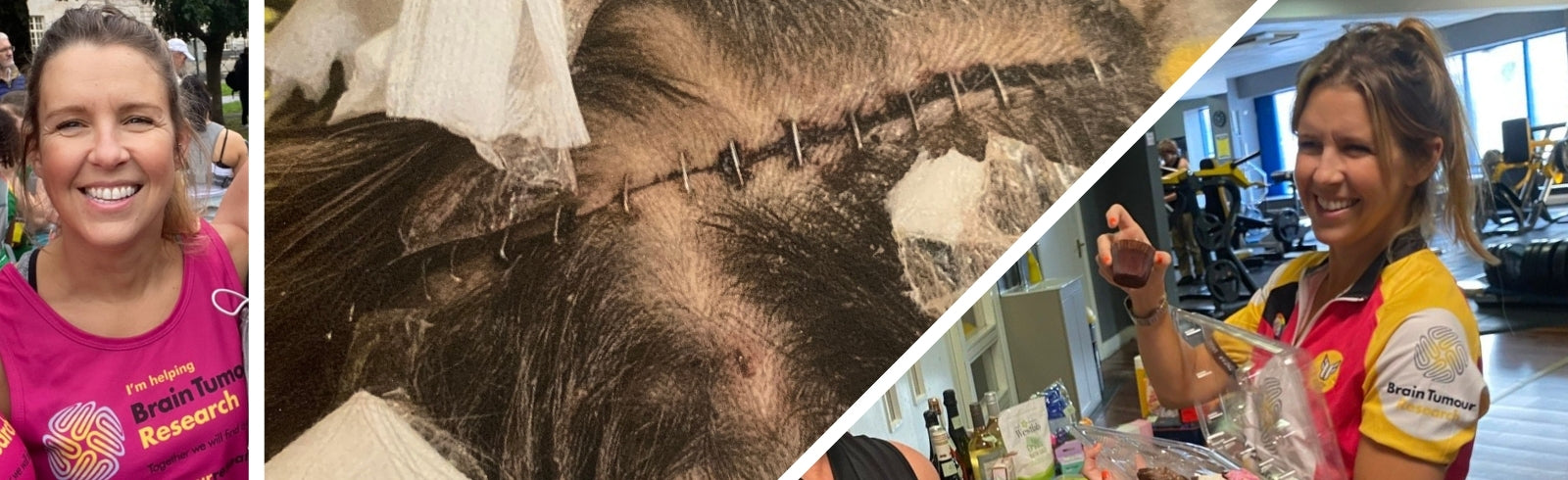 “Lucky” brain tumour survivor funds multiple days of cancer research ...