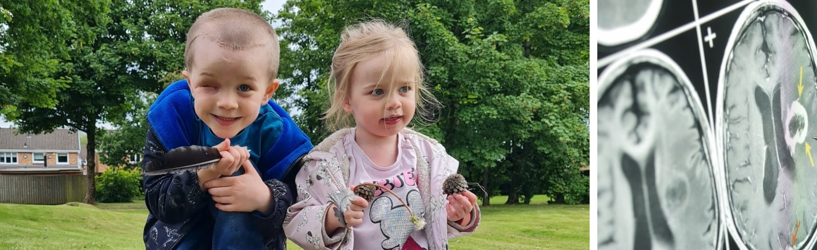 Resilient Riley steps up for cure despite losing vision to tumour ...