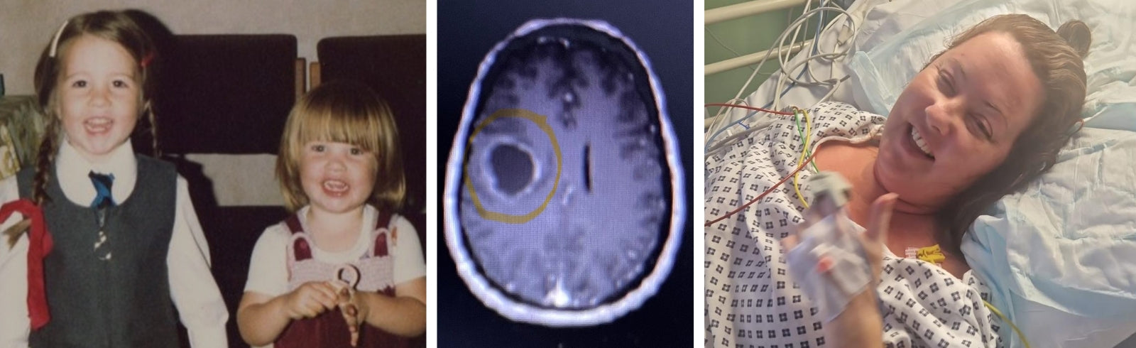 Hertfordshire woman’s fundraising fight to extend life of sister ...