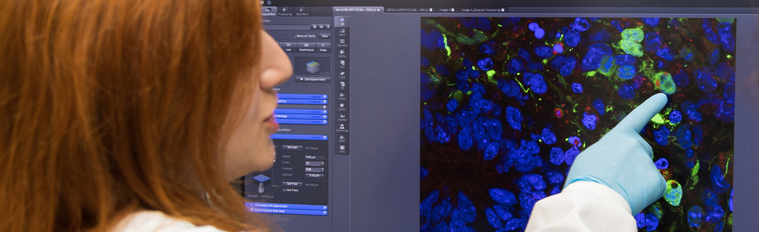 Information Brain Tumour Research