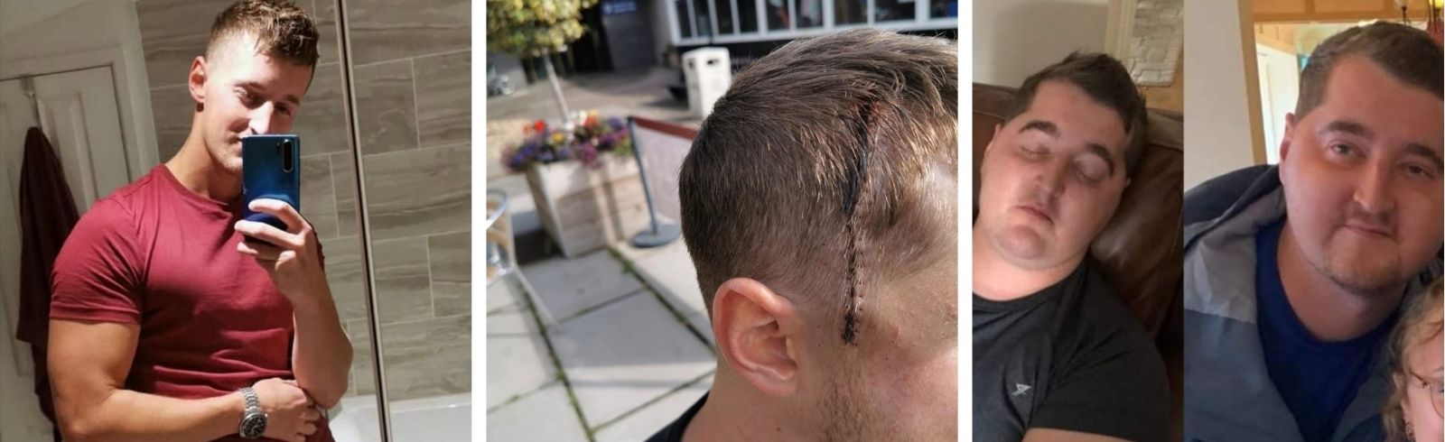 Scott Hinch | Brain Tumour Stories – Brain Tumour Research