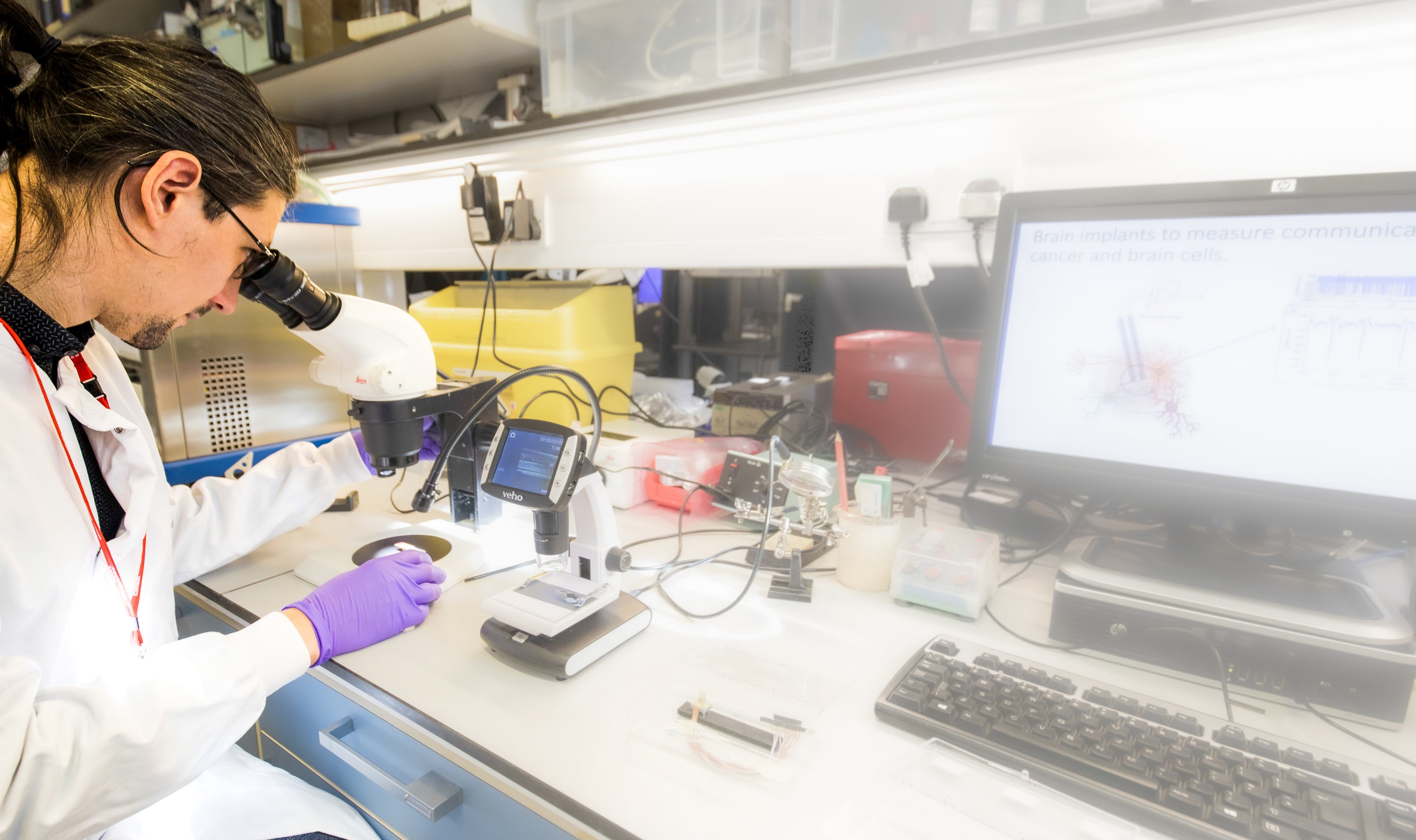 Brain Tumour Research Together We Will Find A Cure